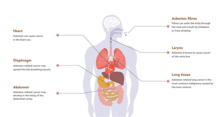 Asbestos Awareness – Workplace Safety – Training Express