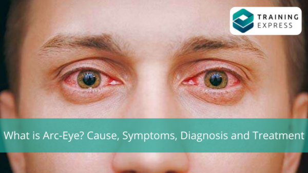 What is Arc Eye? Cause, Symptoms, Diagnosis & Treatment